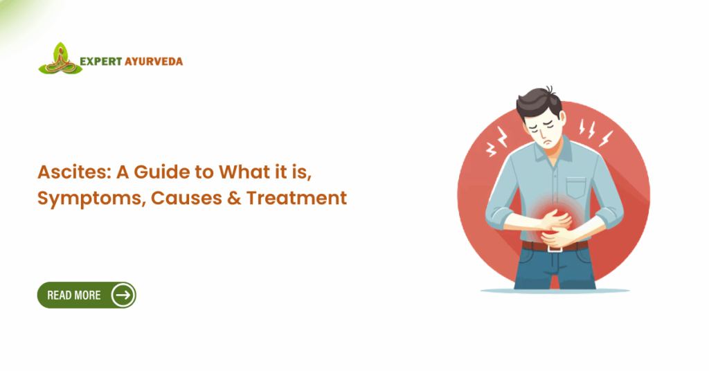 Ascites: A Guide to What it is, Symptoms, Causes & Treatment | Expert ...