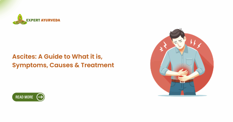 Ascites: A Guide to What it is, Symptoms, Causes & Treatment | Expert ...
